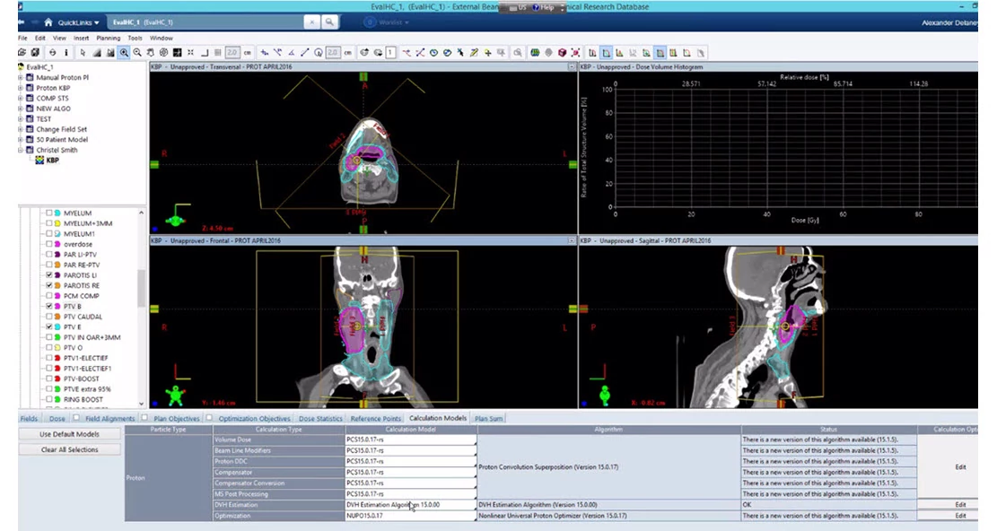 Treatment Planning for the ProBeam System | Varian
