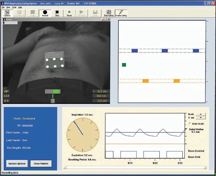 Real-time Tracking and Motion Management | Varian